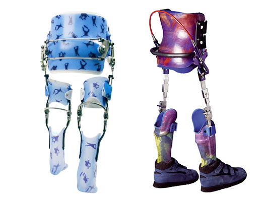 HKAFO Orthosis Unveiled for Optimal Stability