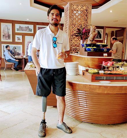 Explore Innovative Prosthetics for Above-Knee, Below-Knee & Bionic ...